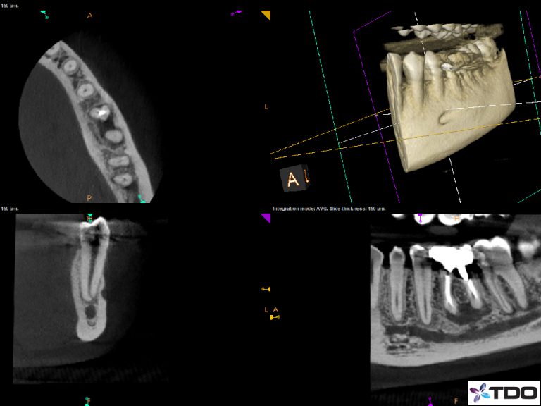 Technology - Advanced MicroEndodontics, P.C.
